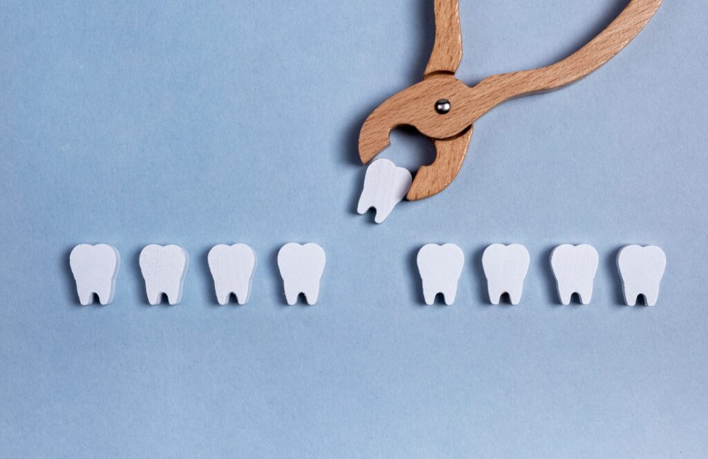 What Can I Eat 24 Hours after Tooth Extraction?